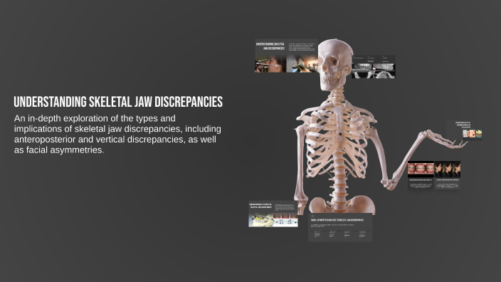 Understanding Skeletal Jaw Discrepancies by Natalia Gurčíková on Prezi