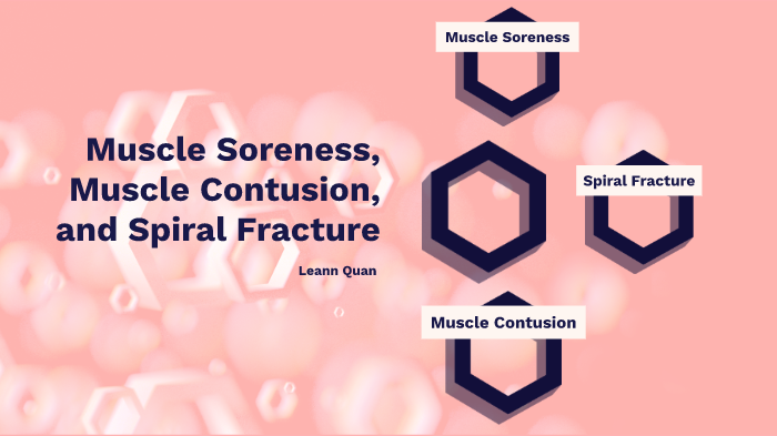 Muscle Soreness, Muscle Contusions, and Spiral Fracture by Leann Quan ...