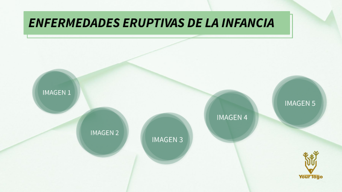 ENFERMEDADES ERUPTIVAS INFANCIA by Juan Alfredo Vera Alcivar on Prezi