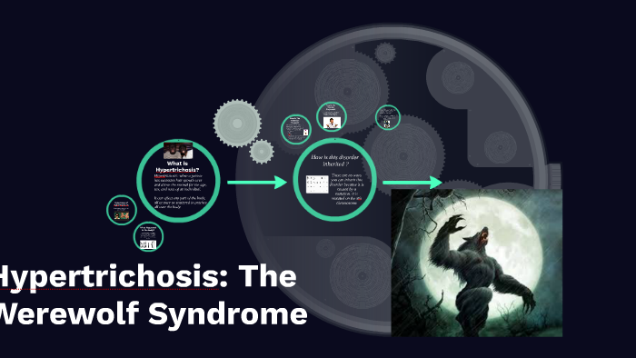 Hypertrichosis: The Werewolf Syndrome by Romaine Trimble on Prezi