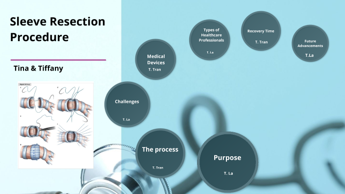 Sleeve Resection (Thoracic) By Tiffany and Tina by Tina ? on Prezi