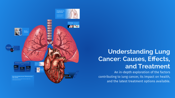 Understanding Lung Cancer: Causes, Effects, and Treatment by Jose ...