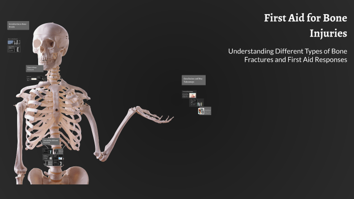 First Aid for Bone Injuries by mmmm mmmmm on Prezi