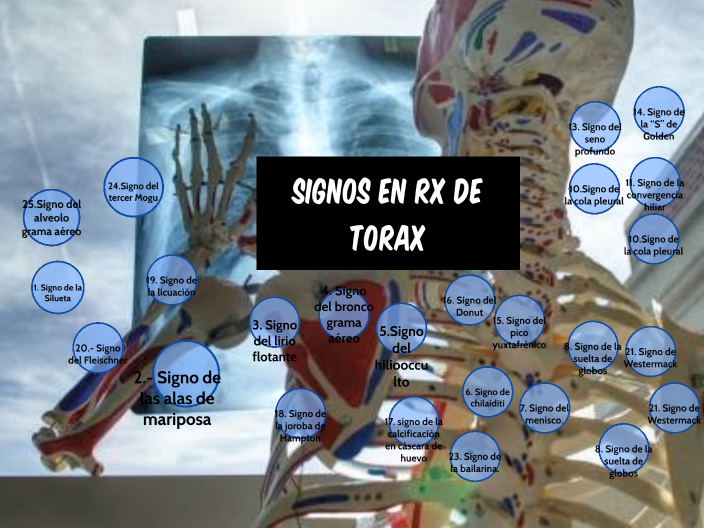 Signos en RX de Tórax by ERIKA VERONICA PABLO PABLO on Prezi