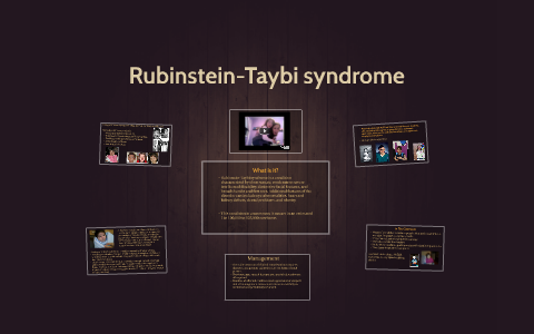 Rubinstein-Taybi syndrome by Ashley Chaffin on Prezi