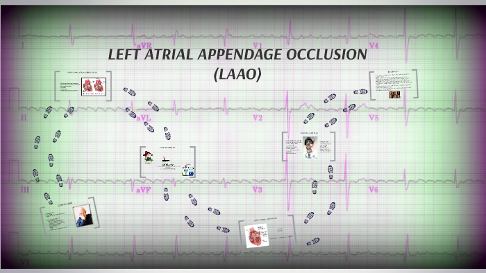 LELEFT ATRIAL APPENDAGE OCCLUSION: (LAAO) by Silvia Muñoz Ramos on Prezi