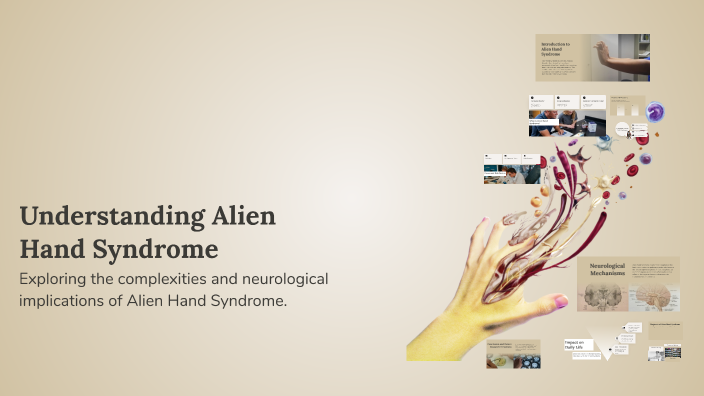 Understanding Alien Hand Syndrome by Ebony Grover on Prezi