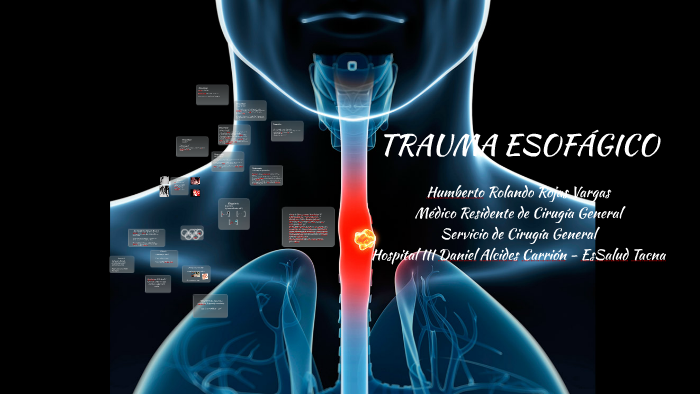 Trauma Esofágico by Humberto Rolando Rojas Vargas on Prezi