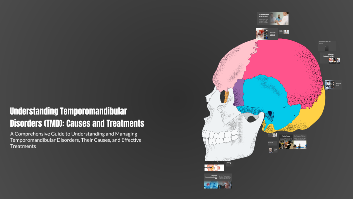 Understanding Temporomandibular Disorders (TMD): Causes and Treatments ...