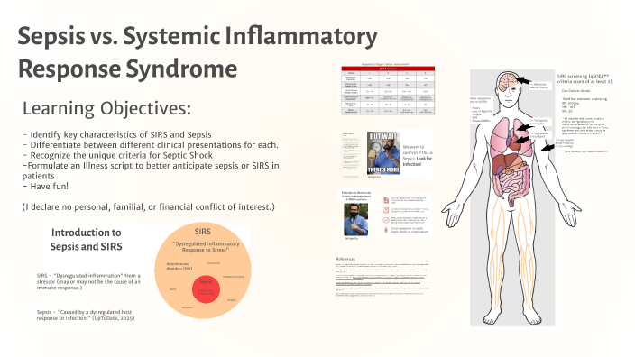 Exploring the Human Body: Sepsis vs. SIRS by Danny Barrera on Prezi