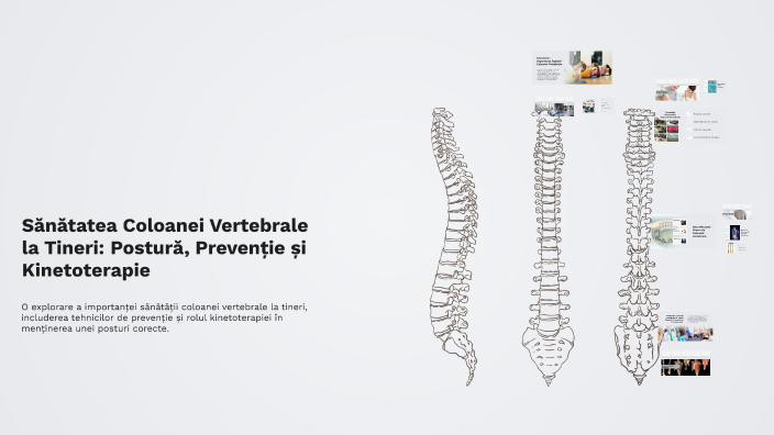 Sănătatea Coloanei Vertebrale la Tineri: Postură, Prevenție și ...