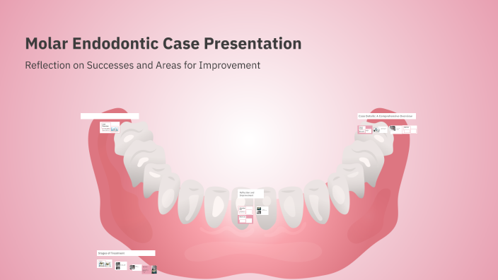 Molar Endodontic Case Presentation by Ayan Zaki on Prezi