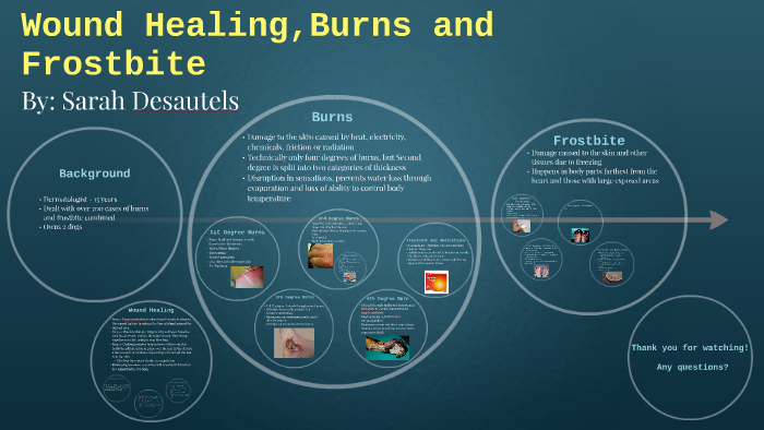 Burns frostbite wound healing by Sarah Desautels on Prezi