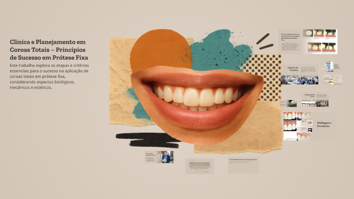 Clínica e Planejamento em Coroas Totais – Princípios de Sucesso em ...