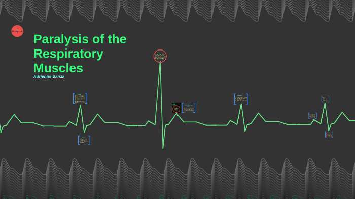 Paralysis of the Respiratory Muscles by asanza 21 on Prezi