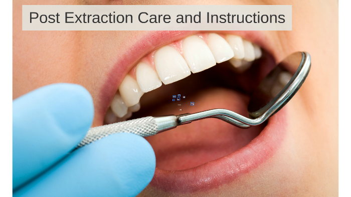 Post Extraction Care and Instructions by Lubna Elsayed on Prezi