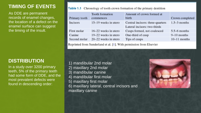 Developmental defect enamel by nadia waliyah on Prezi