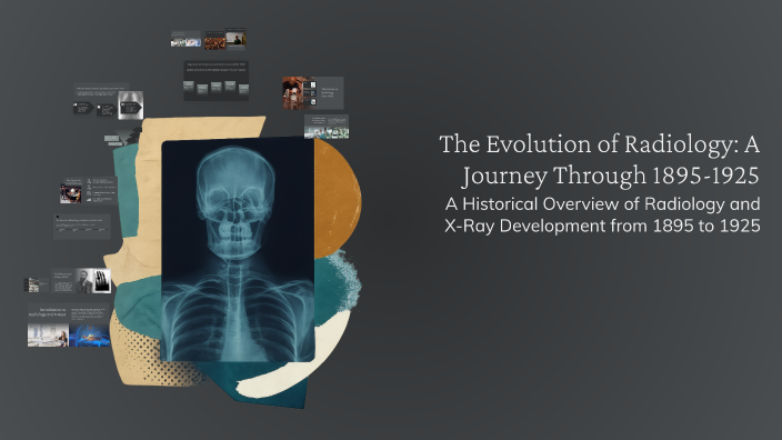 The Evolution of Radiology: A Journey Through 1895-1925 by Alice ...