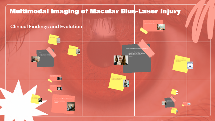 Multimodal Imaging of Macular Blue-Laser Injury by Ana Fernandez on Prezi