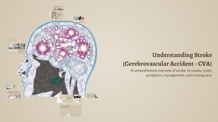 Understanding Stroke (Cerebrovascular Accident - CVA) by Mohamed on Prezi