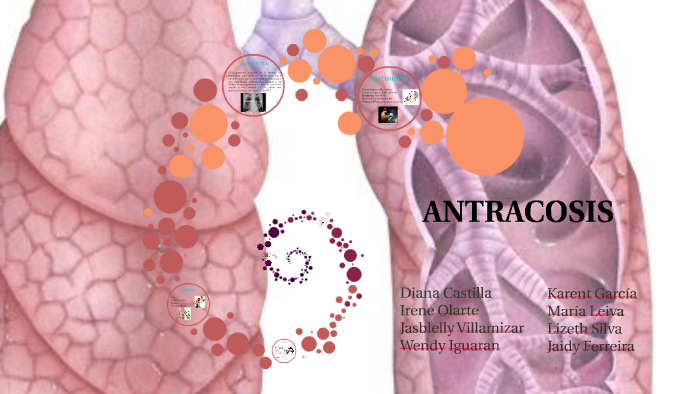 ANTRACOSIS by Jasblelly Jolie Villamizar Salazar on Prezi