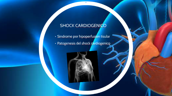 SHOCK CARDIOGENICO by alejandro mendez on Prezi