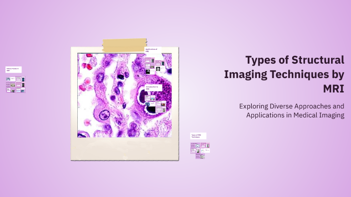 Types of Structural Imaging Techniques by MRI by Pezhman Kiani on Prezi