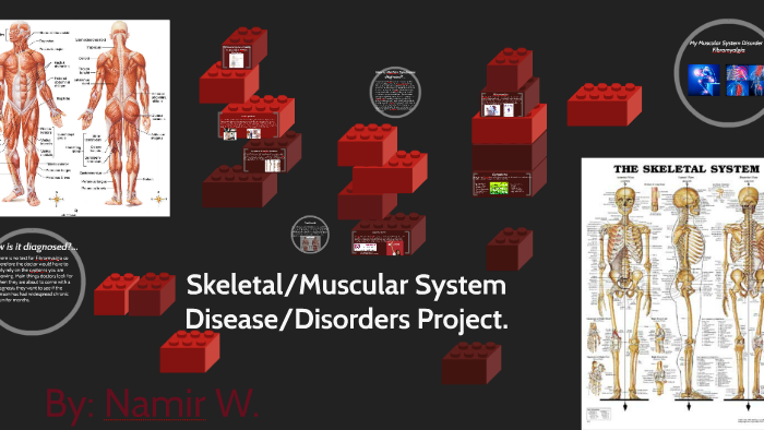 Skeletal/Muscular System Disease/Disorders Project. by Namir Watson on ...