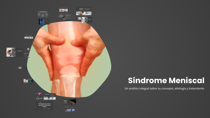 Síndrome Meniscal by María de Jesús Tenorio Cordero on Prezi