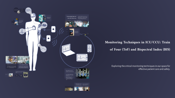 Monitoring Techniques in Anesthesia: Train of Four and Bispectral Index ...