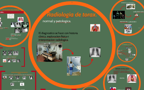 Radiologia de torax. by carlos rodolfo radillo yee on Prezi