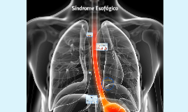 Sindrome Esofagico by Fabricio Franco on Prezi