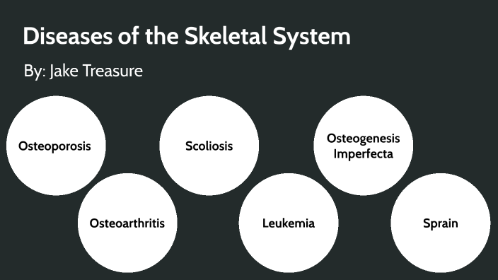Diseases of the Skeletal System by Jake Treasure on Prezi