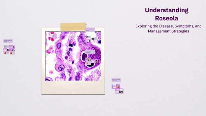 Understanding Roseola: A Comprehensive Overview by _Cubic-Gamers_ on Prezi