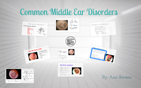 Middle ear disorders by Ann Brewer on Prezi