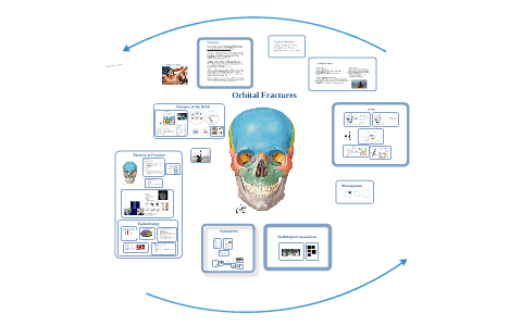 Periorbital Fractures by James English on Prezi