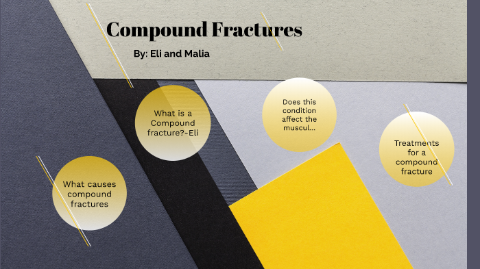 Compound Fractures by Student Eli McWilliams on Prezi