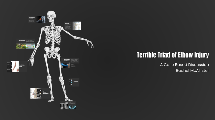 Terrible Triad of Elbow Injury by Rachel McAllister on Prezi