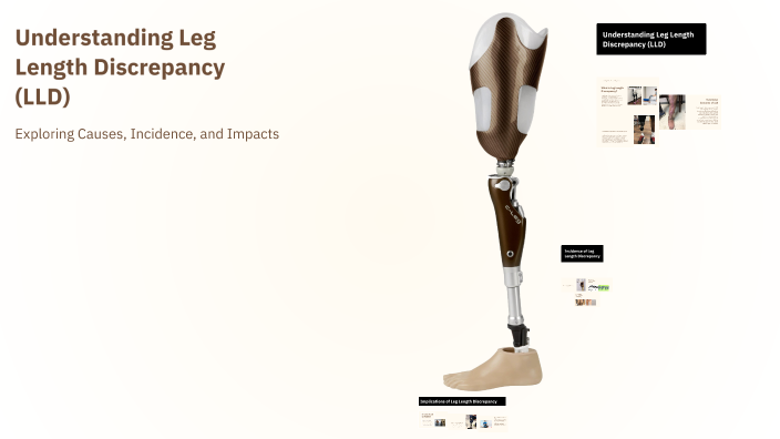 Understanding Leg Length Discrepancy (LLD) by Dhulikhel Research on Prezi