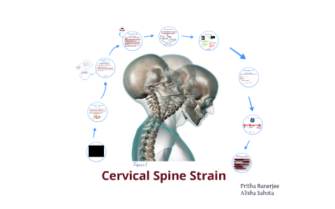 Cervical Spine Strain by Alisha Kay on Prezi