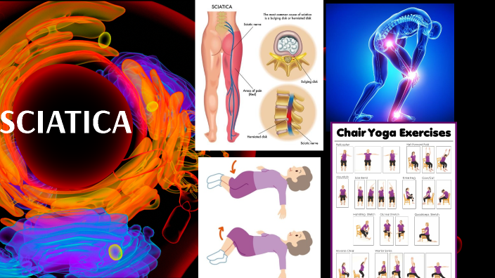 Sciatica by Shenika Edwards Jerrick on Prezi