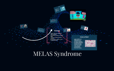 MELAS Syndrome by Melissa Lamb on Prezi