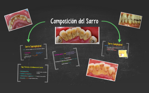 Composicion del Sarro by Lotzi Ramirez on Prezi