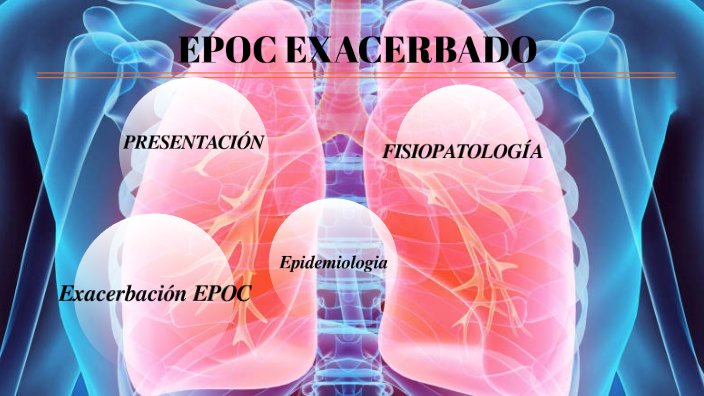 EPOC EXACERBADO by SERGIO SOTO SALINAS on Prezi