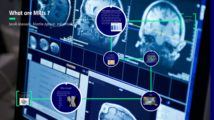 How do MRIs Work? by Jacob Atanasio