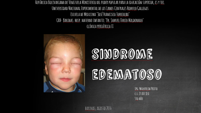 sindrome edematoso by Walker Prieto on Prezi