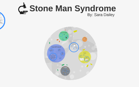 Stone Man Syndrome by Sara Dailey on Prezi
