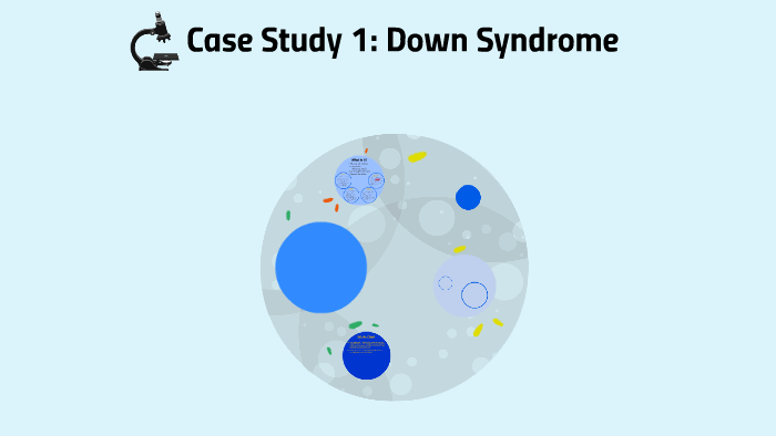 Case Study 1: Down Syndrome by Angel Chung on Prezi