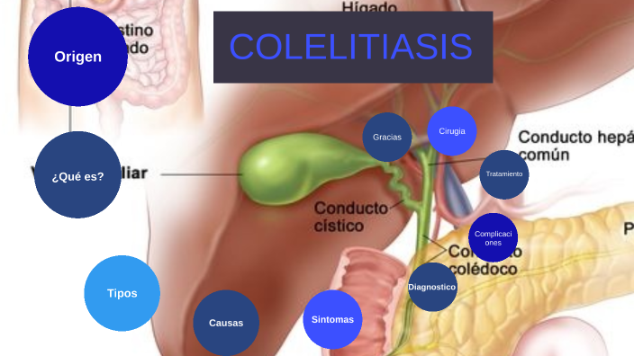 Colelitiasis by Leonel Blas on Prezi