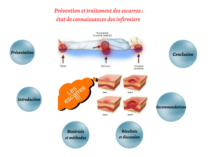 les escarres 1 by Dahmen Mariem on Prezi